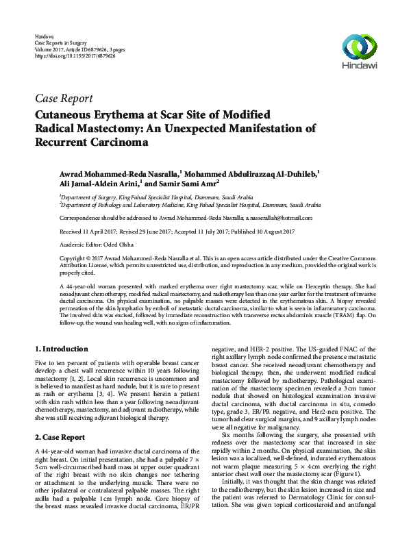 (PDF) Cutaneous Erythema at Scar Site of Modified Radical Mastectomy ...