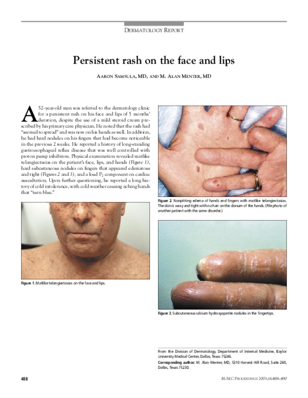 (PDF) Persistent Rash on the Face and Lips | Alan Menter - Academia.edu