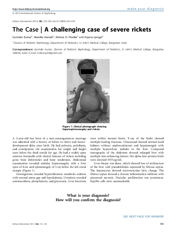 (PDF) The Case ∣ A challenging case of severe rickets