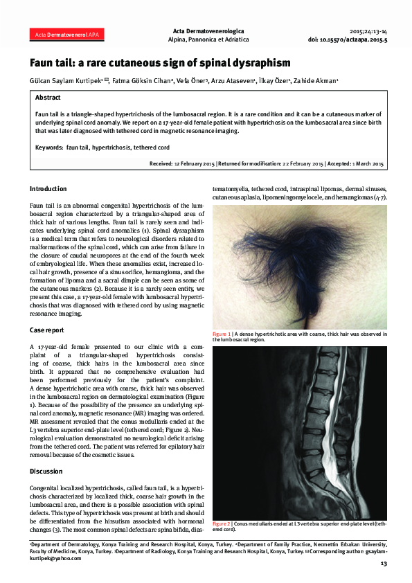 (PDF) Faun tail: a rare cutaneous sign of spinal dysraphism