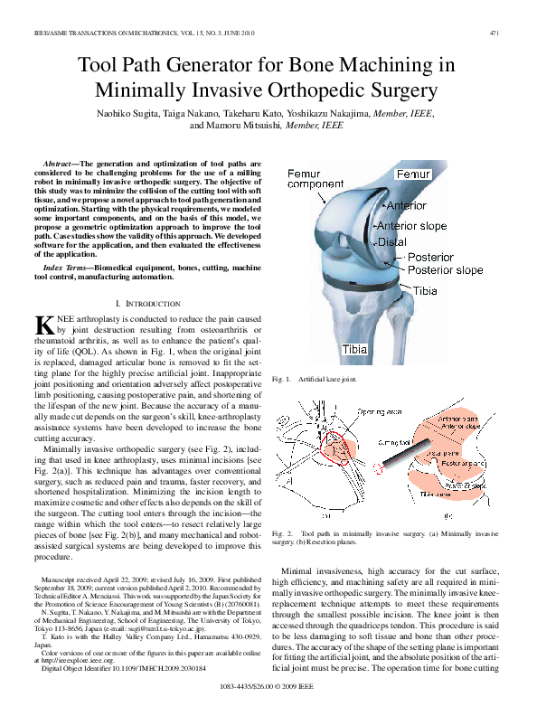 (PDF) Robotized System for Bone Drilling and Cutting in Orthopedic Surgery | Kazimir Zagurski ...