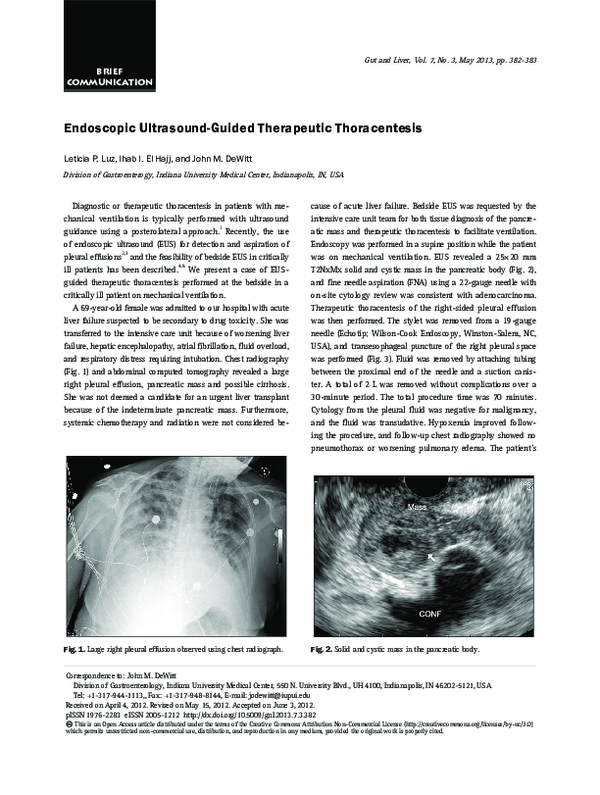 (PDF) Endoscopic Ultrasound-Guided Therapeutic Thoracentesis