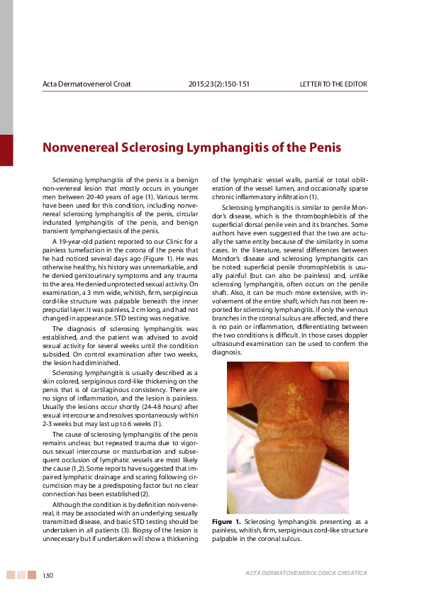 (PDF) Nonvenereal sclerosing lymphangitis of the penis