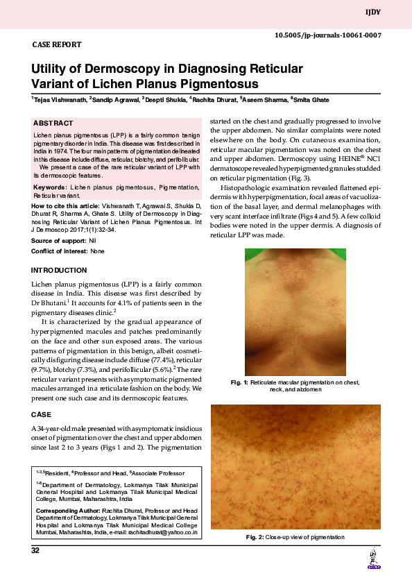(PDF) Utility of Dermoscopy in Diagnosing Reticular Variant of Lichen Planus Pigmentosus