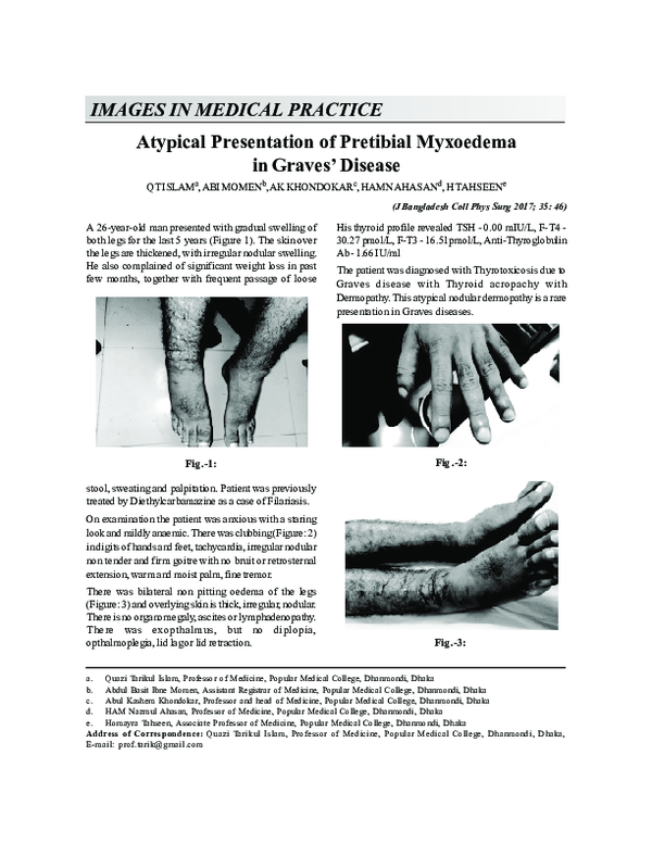 (PDF) Atypical Presentation of Pretibial Myxoedema in Graves’ Disease