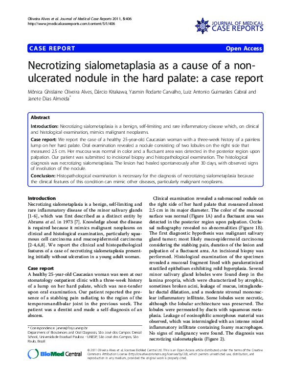 (PDF) Necrotizing sialometaplasia as a cause of a non-ulcerated nodule ...