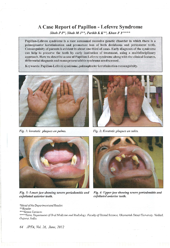 (PDF) A Case Report of Papillon - Lefevre Syndrome