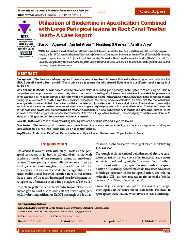 (PDF) Utilization of Biodentine in Apexification Combined with Large ...