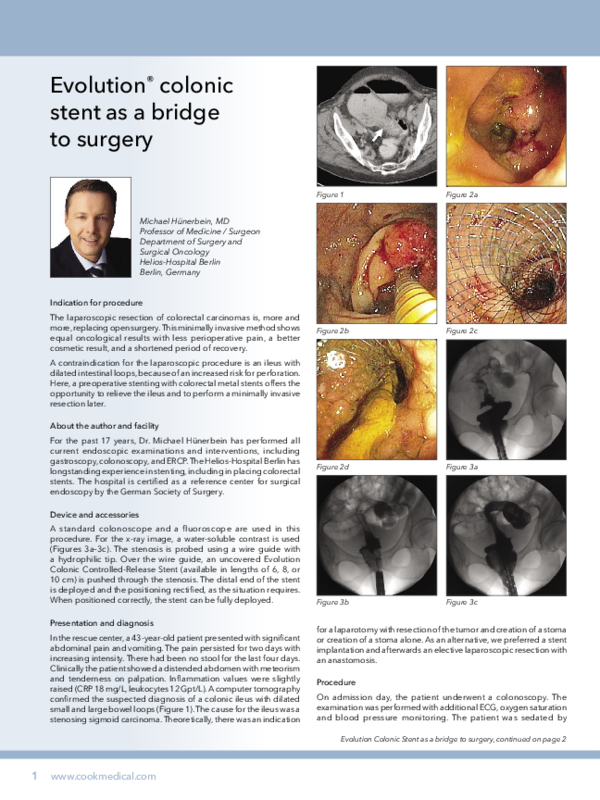 (PDF) Colonic Stent: Bridge to Surgery