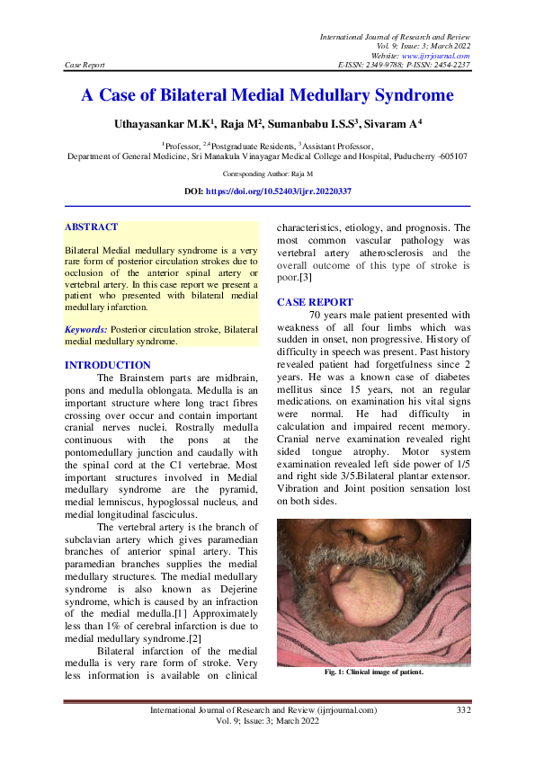 (PDF) A Case of Bilateral Medial Medullary Syndrome
