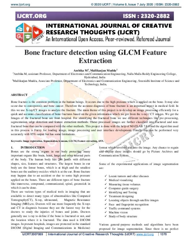 Pdf Bone Fracture Detection Using Glcm Feature Extraction