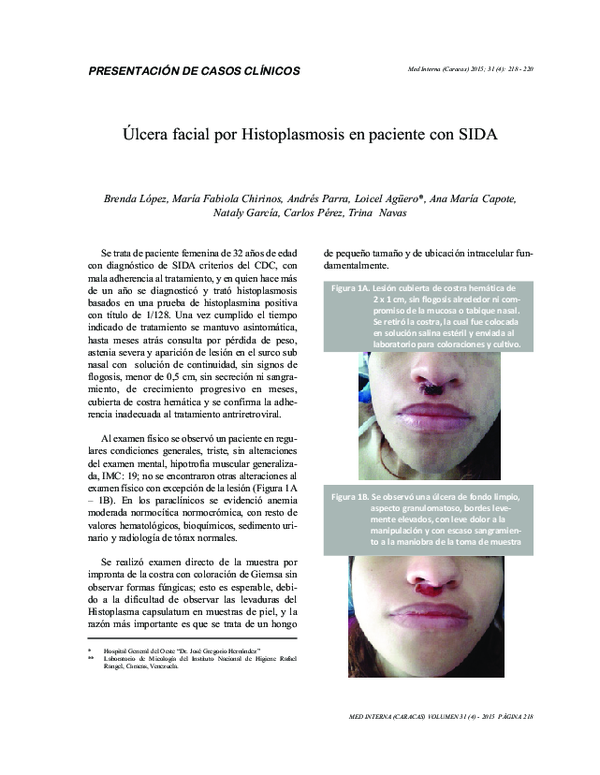 (PDF) Úlcera facial por Histoplasmosis en paciente con SIDA