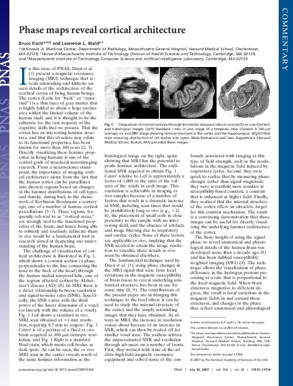(PDF) Phase maps reveal cortical architecture