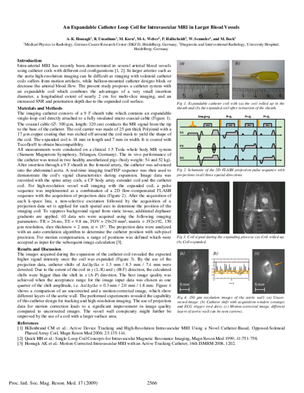 (PDF) An expandable catheter loop coil for intravascular MRI in larger ...