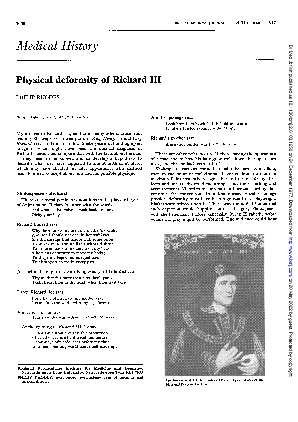 (PDF) Physical deformity of Richard III | Jonathan Potter - Academia.edu