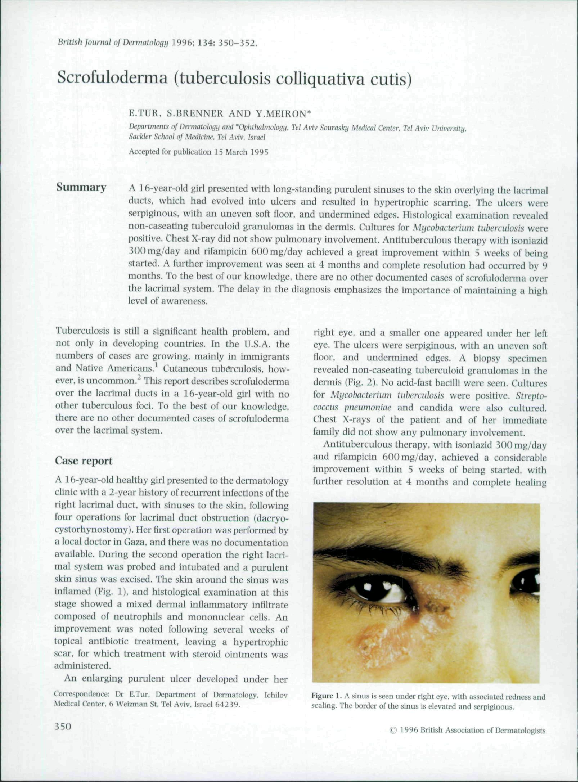 (PDF) Scrofuloderma (tuberculosis colliquativa cutis)