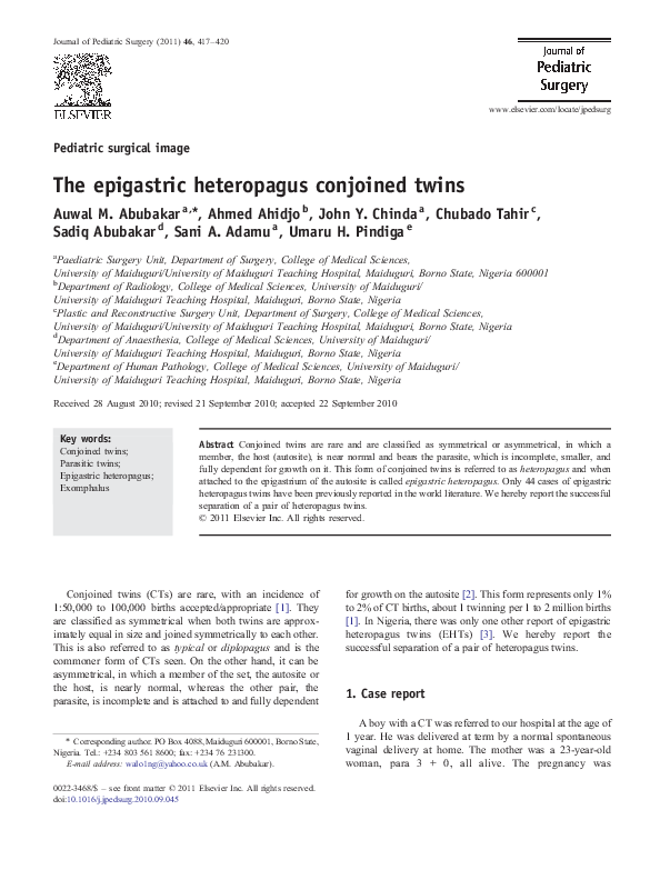 (PDF) The epigastric heteropagus conjoined twins