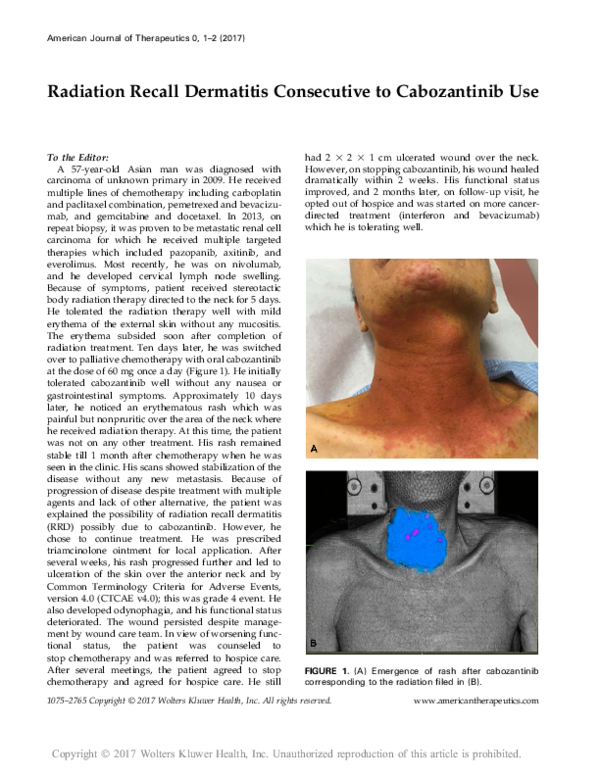 (PDF) Radiation Recall Dermatitis Consecutive to Cabozantinib Use