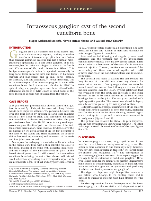 (PDF) Intraosseous ganglion cyst of the second cuneiform bone
