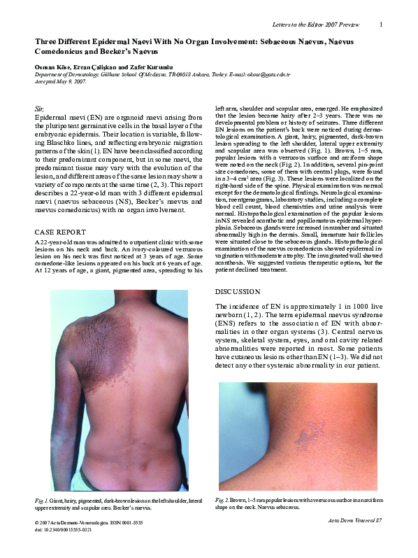 (PDF) Three Different Epidermal Naevi With No Organ Involvement ...