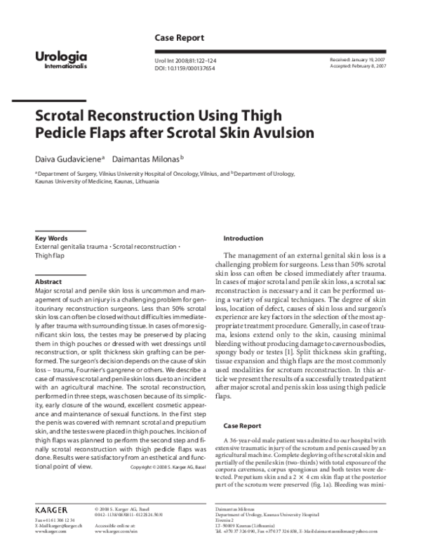 (PDF) Scrotal reconstruction using thigh pedicle flaps: long-term ...