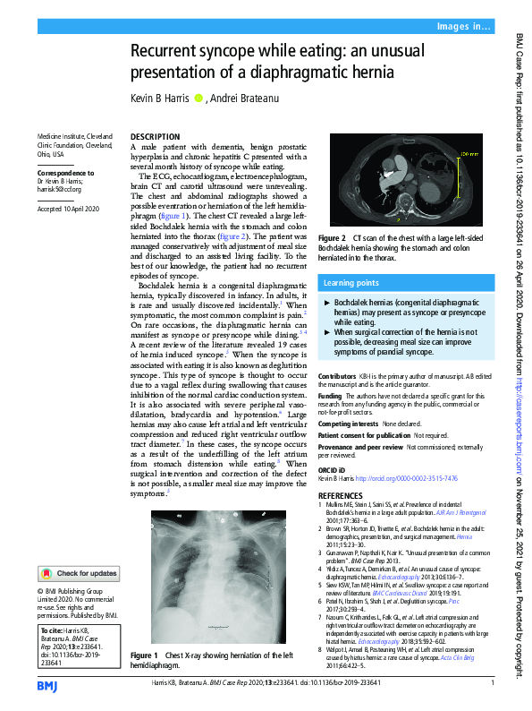 (PDF) Recurrent syncope while eating: an unusual presentation of a ...
