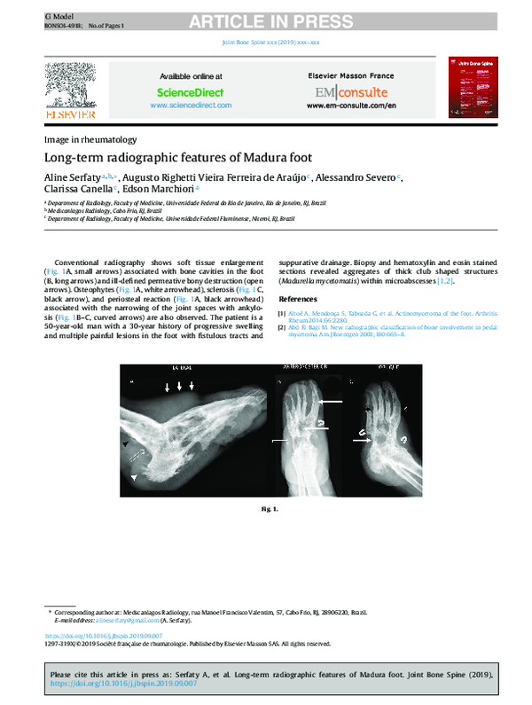 (PDF) Long Term Radiographic Features of Madura Foot