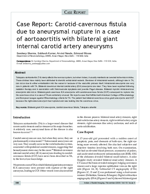 (PDF) Case Report: Carotid-cavernous fistula due to aneurysmal rupture ...