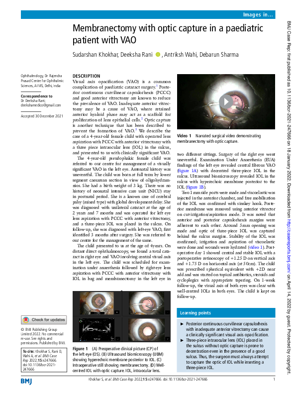 (PDF) Membranectomy with optic capture in a paediatric patient with VAO