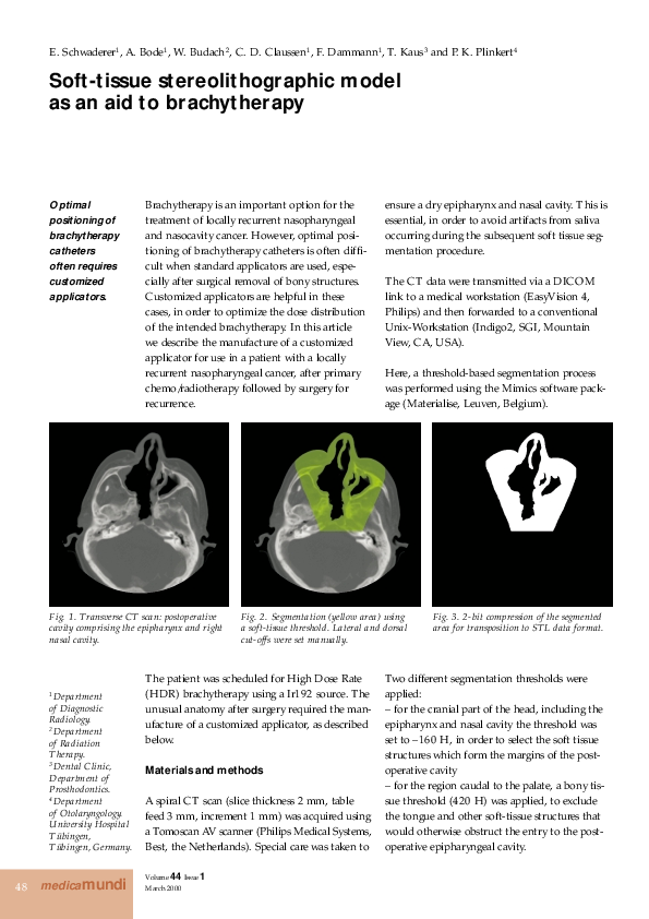Pdf Soft Tissue Stereolithographic Model As An Aid To Brachytherapy
