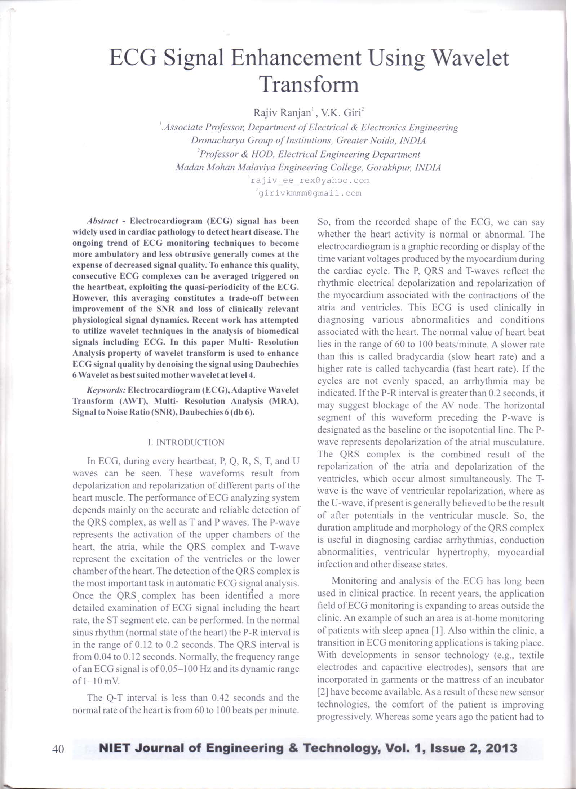 (PDF) ECG Signal Enhancement Using Wavelet Transform