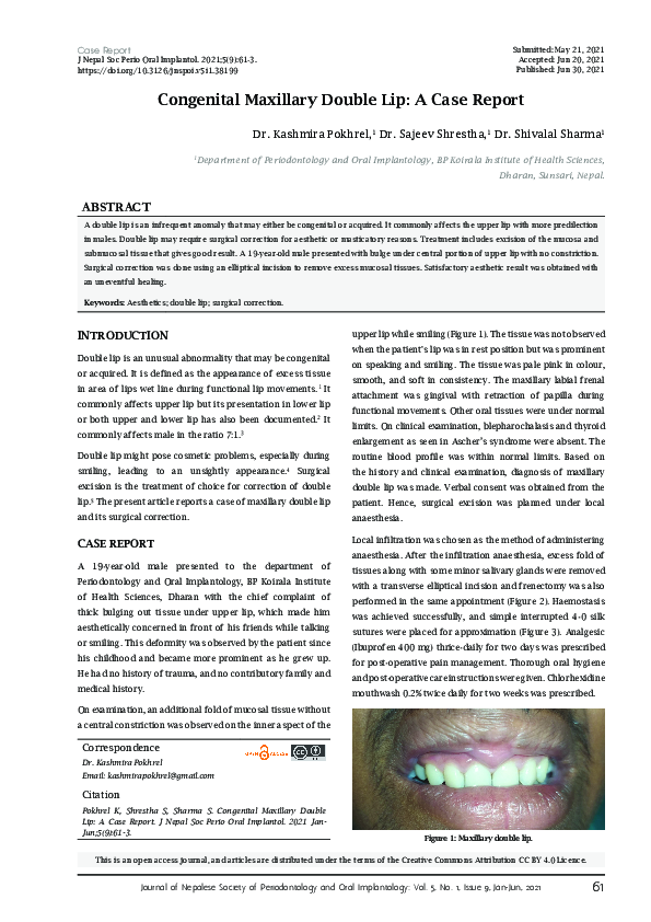 (PDF) Congenital Maxillary Double Lip: A Case Report