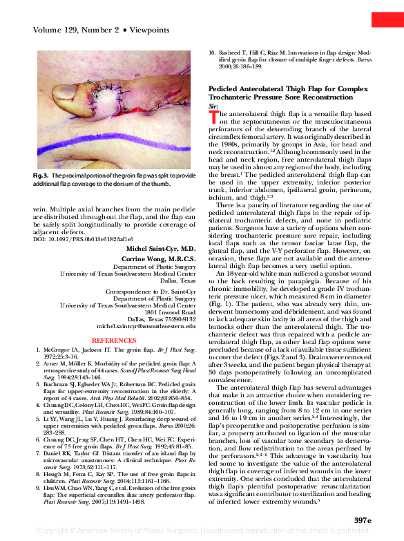 (PDF) Pedicled Anterolateral Thigh Flap for Complex Trochanteric ...