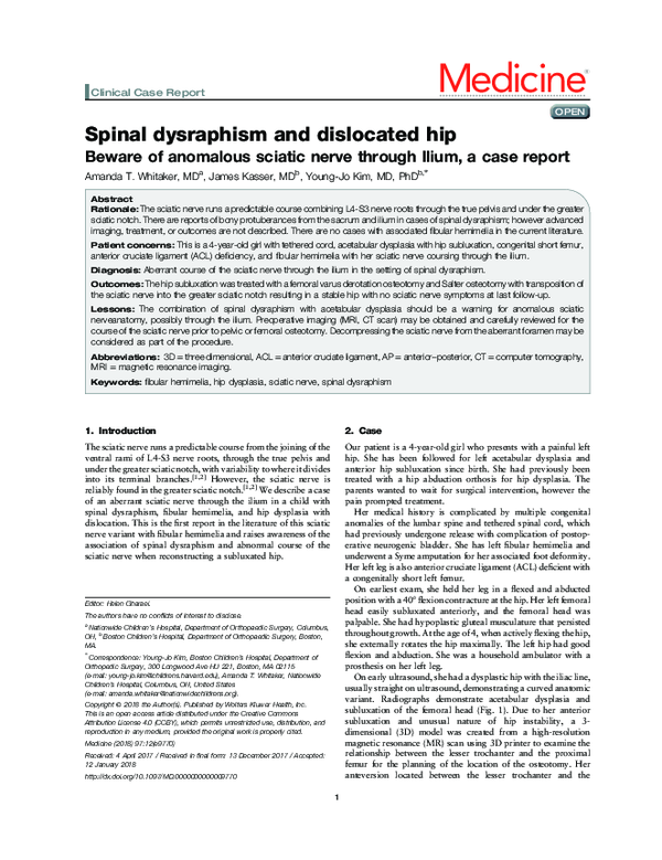 (PDF) Spinal dysraphism and dislocated hip: Beware of anomalous sciatic nerve through Ilium, a ...