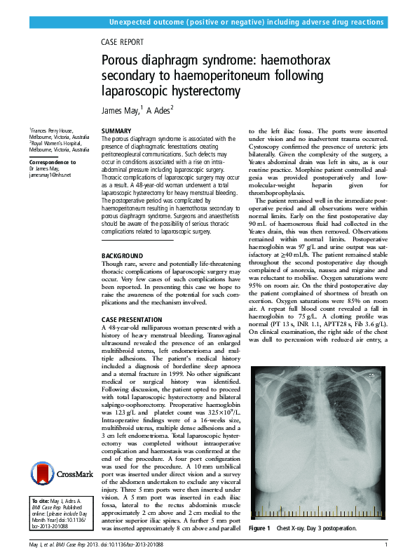 (PDF) Porous diaphragm syndrome: haemothorax secondary to ...