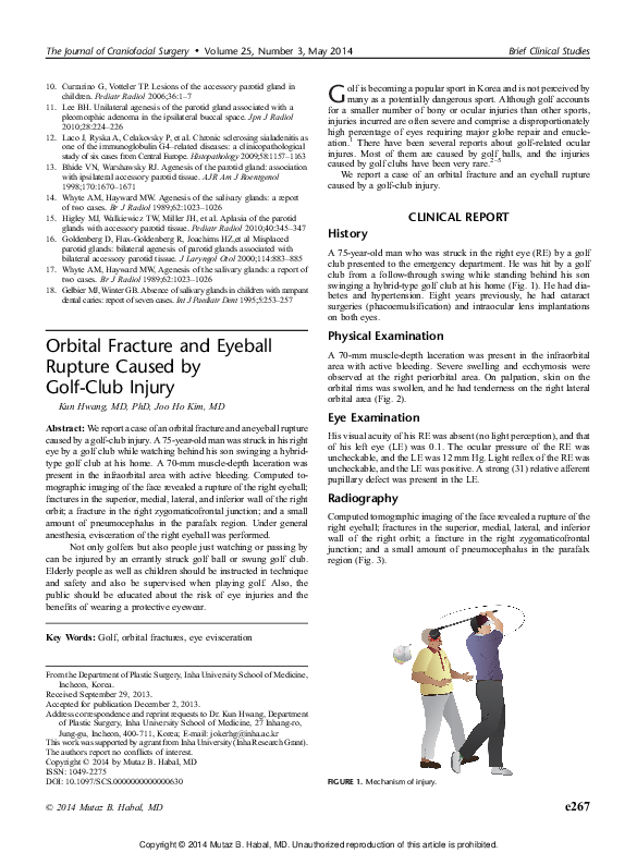 (PDF) Orbital Fracture and Eyeball Rupture Caused by Golf-Club Injury ...