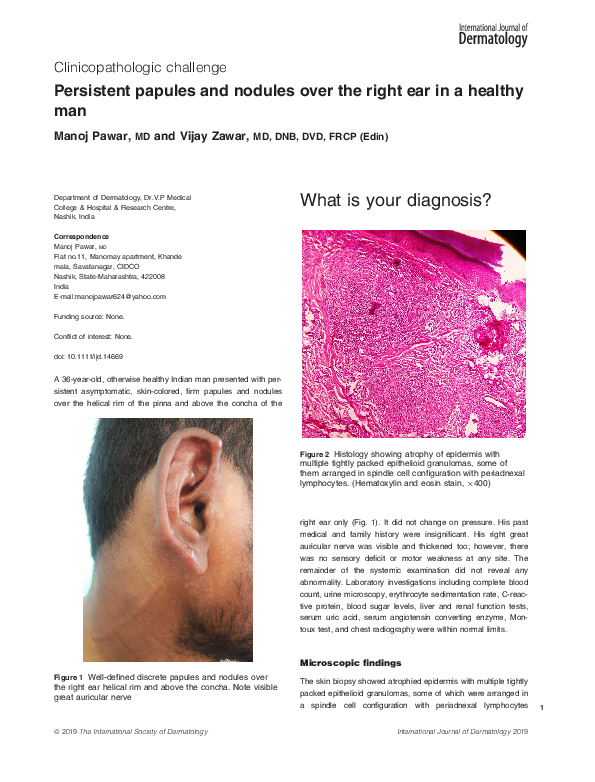 (PDF) Persistent papules and nodules over the right ear in a healthy man