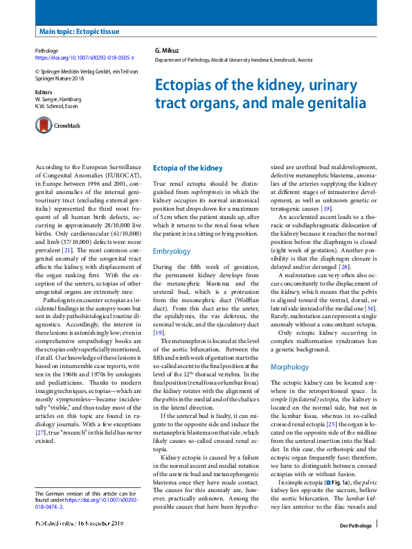 (PDF) Ectopias of the kidney, urinary tract organs, and male genitalia
