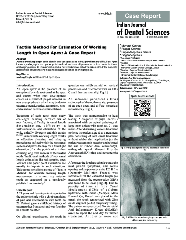 Pdf Tactile Method For Estimation Of Working Length In Open Apex A Case Report