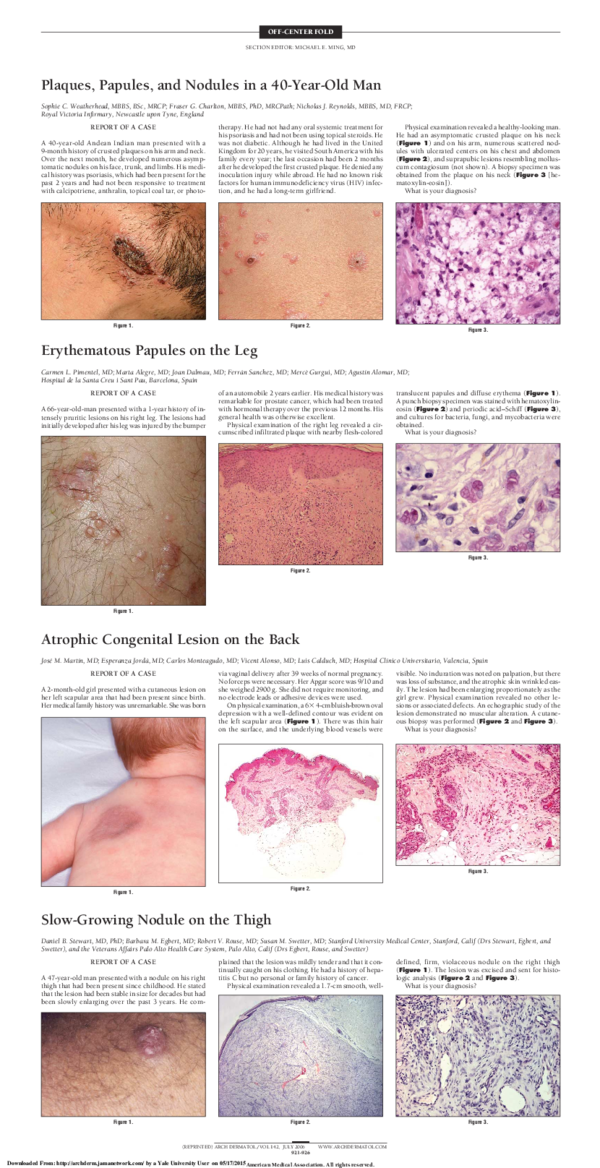 (PDF) Erythematous Papules on the Leg—Quiz Case | Joan Dalmau ...