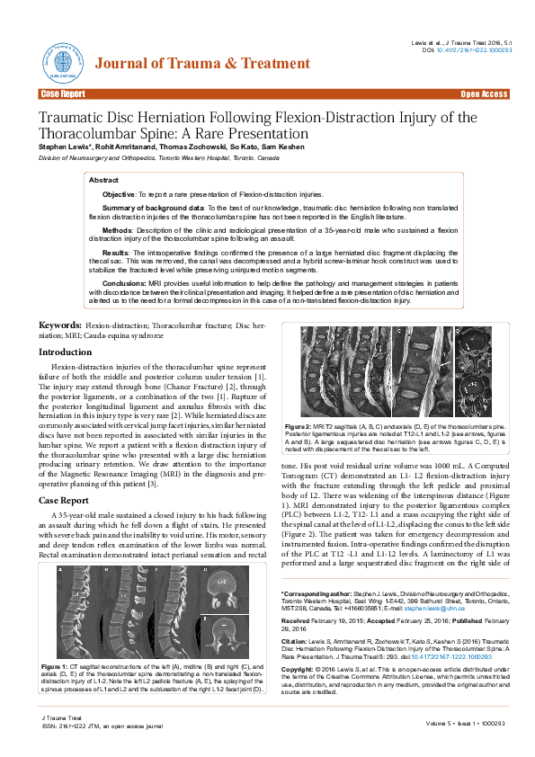 (PDF) Traumatic Disc Herniation Following Flexion-Distraction Injury of ...