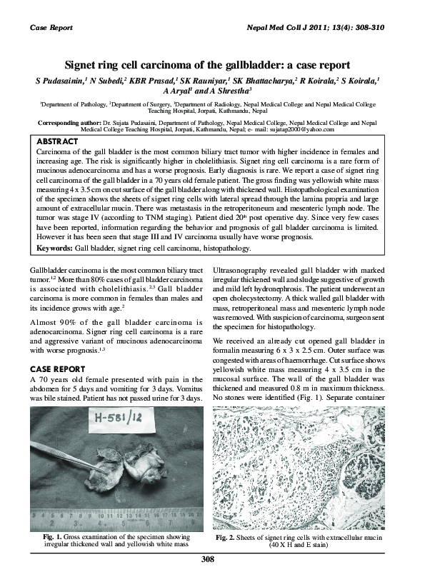 (PDF) Signet-ring cell carcinoma of the gallbladder: a case report