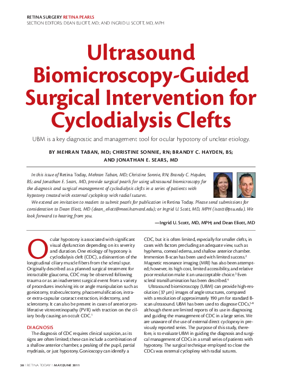 (PDF) Ultrasound biomicroscopy-guided surgical intervention for ...
