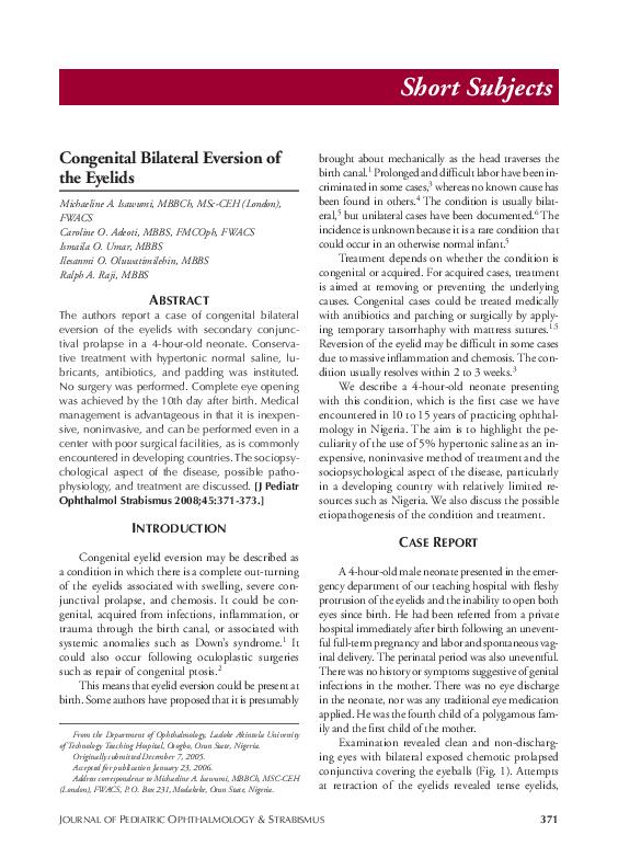 (PDF) Congenital Bilateral Eversion of the Eyelids