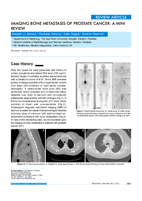 (PDF) Imaging Bone Metastasis of Prostate Cancer: A Mini Review