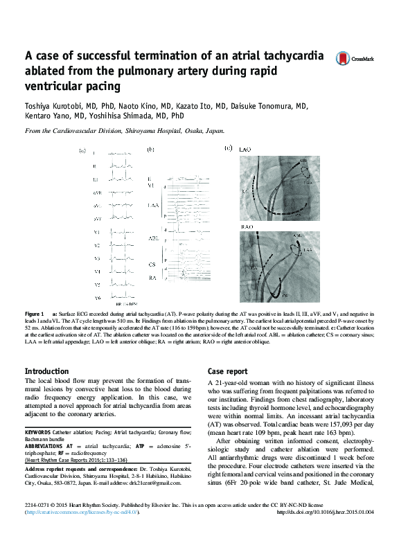 (PDF) A case of successful termination of an atrial tachycardia ablated ...