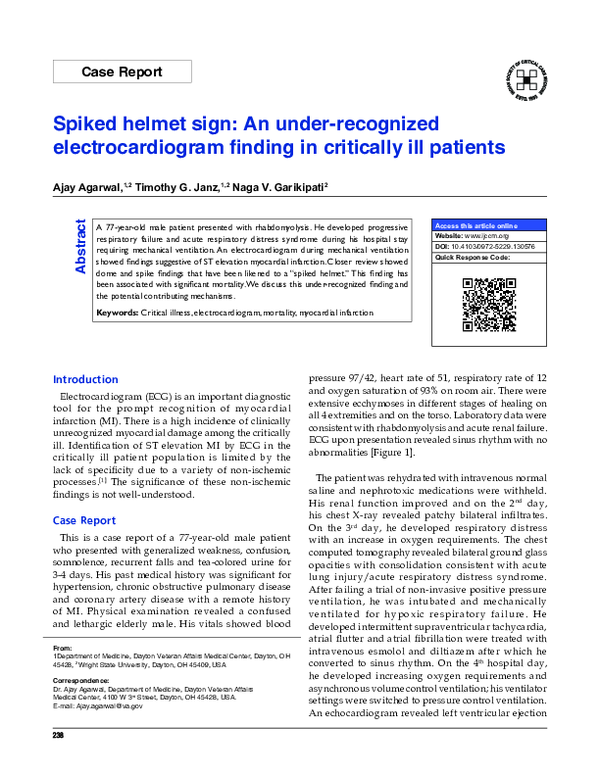 (PDF) Spiked helmet sign: An under-recognized electrocardiogram finding ...
