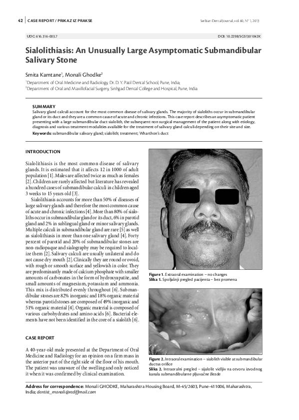 (PDF) Sialolithiasis: An unusually large asymptomatic submandibular ...