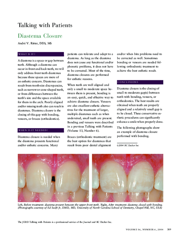 (PDF) Talking with Patients Diastema Closure | Andre Ritter - Academia.edu
