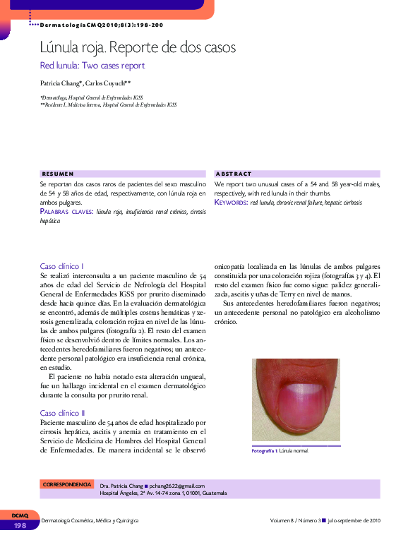 (PDF) Red lunula: Two cases report
